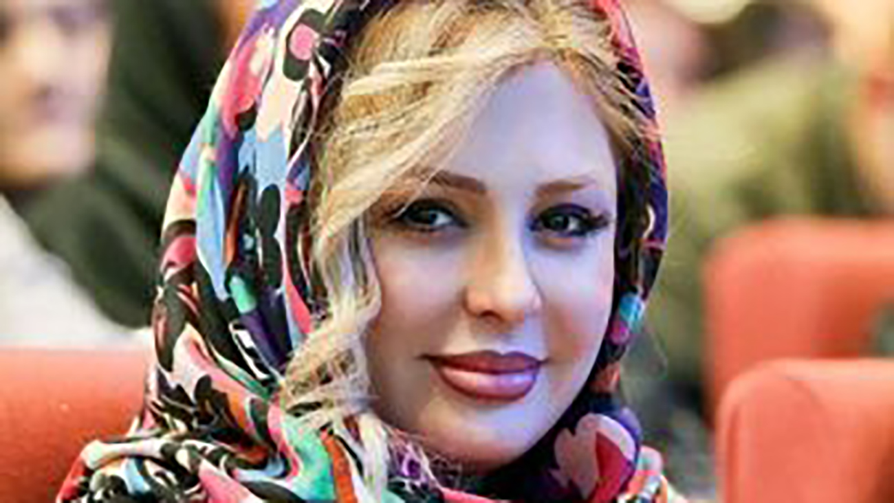 نیوشا ضیغمی از بینی جدیدش رونمایی کرد چقدر جوان شده است عکس